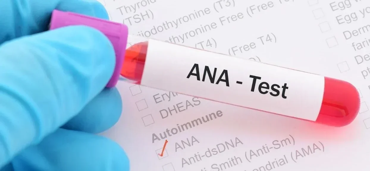Antinuclear Antibodies Test (ANA)
